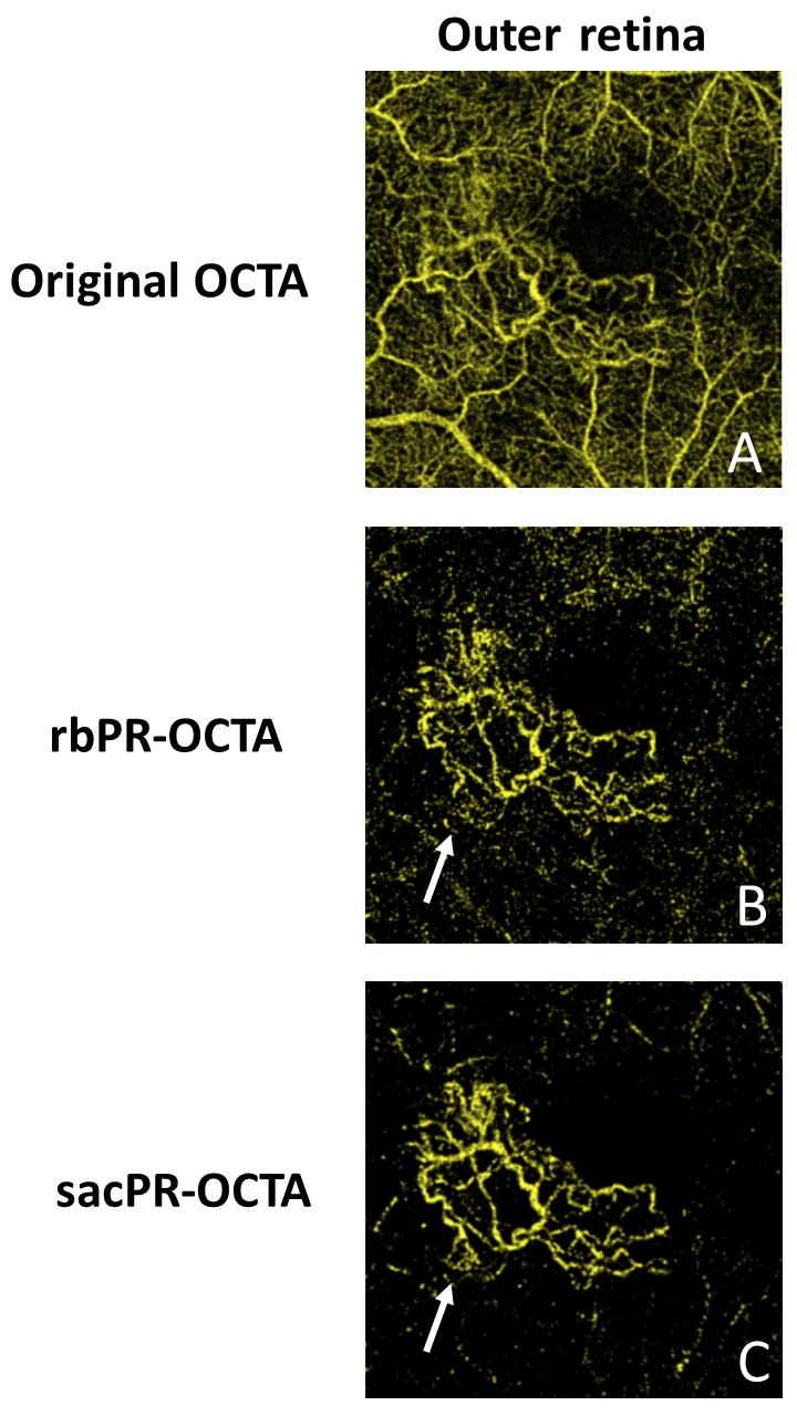 Technology Transfer | OHSU